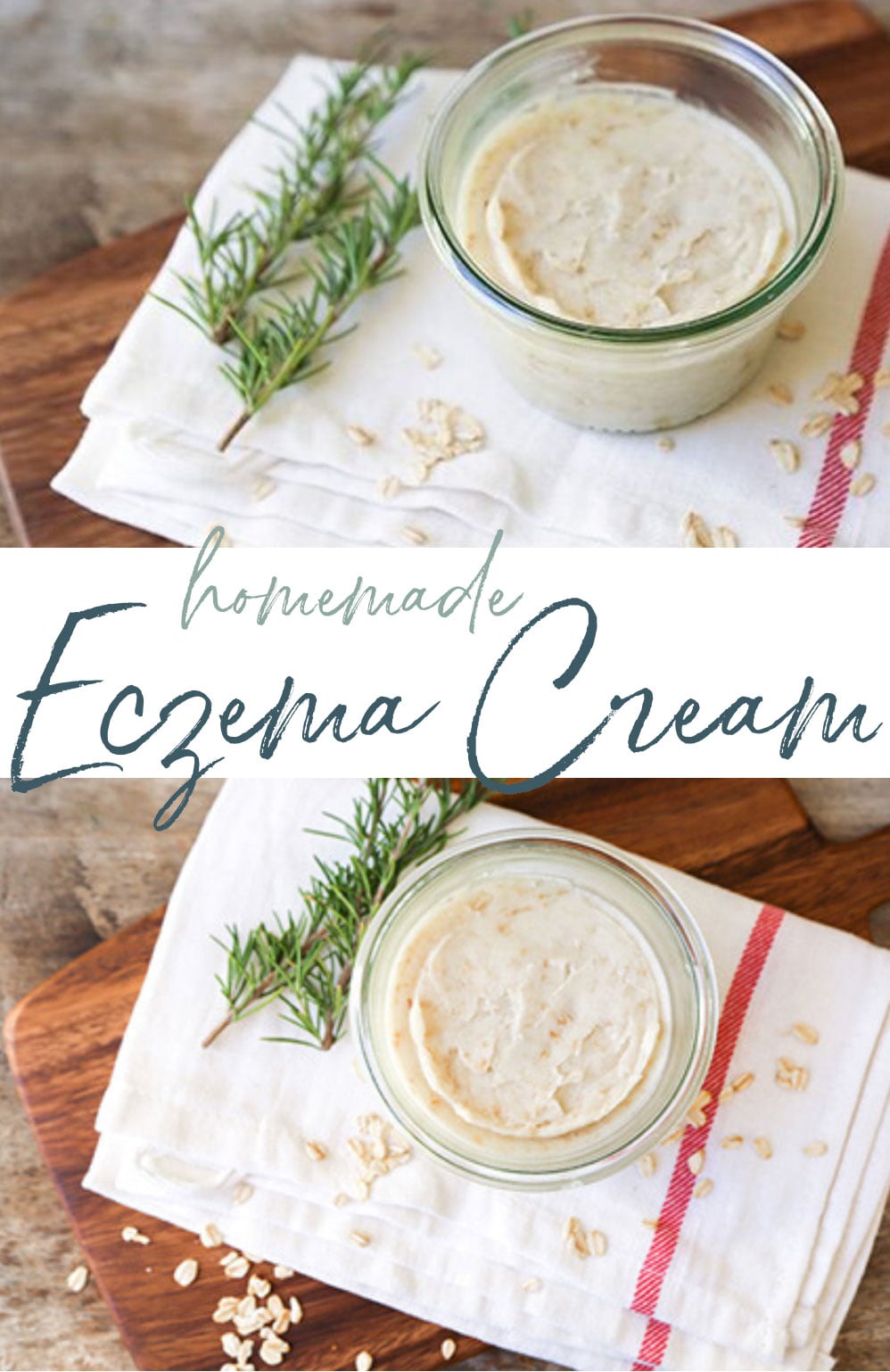 Homemade Eczema Cream
